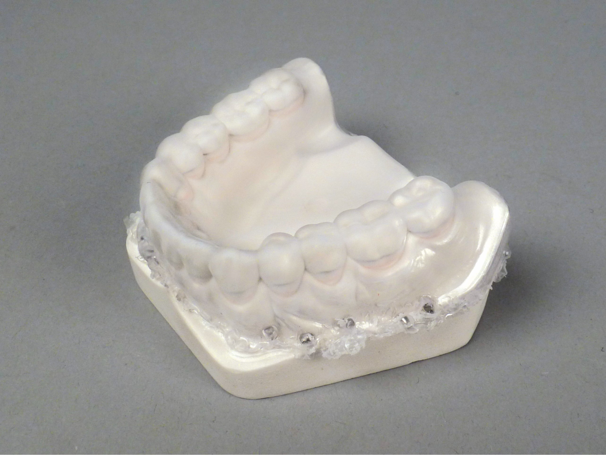 Durasplint - a tech review — Eurodontic